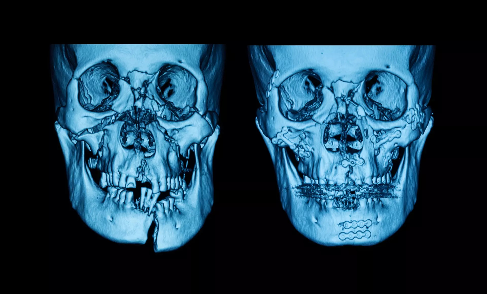 Best Facial Trauma And Lacerations treatments St Louis, MO | Synergi ...