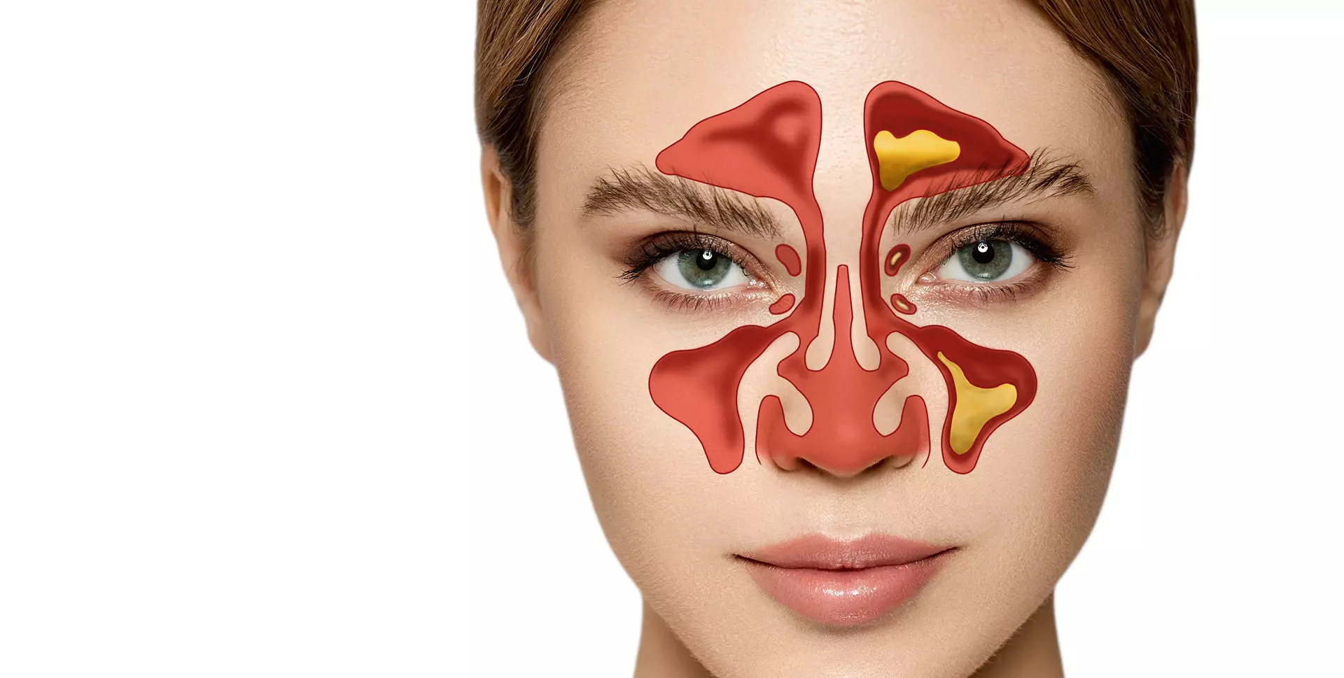 Best General Otolaryngology Procedures St Louis, MO | Synergi Facial ...